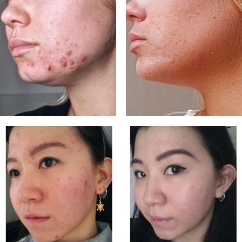 Vanessa Megan The Holy Trinity Daily Skincare Routine Minis | Shop ...